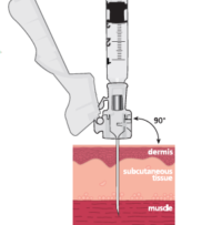 Injection Routes • HowToDoInjections.com