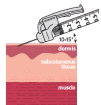 Injection Routes • HowToDoInjections.com